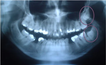 Cirurgias - Sarkissian Odontologia